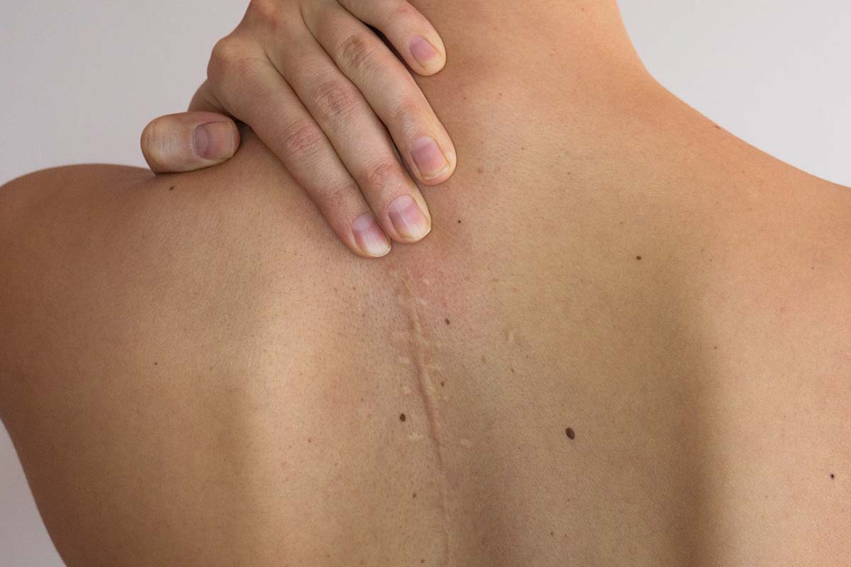 Conditions | Paradise Dermatology in Sarasota, FL